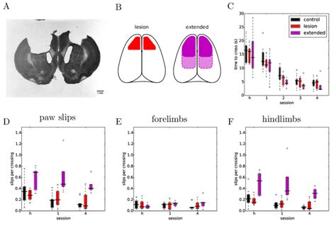 Extended Frontoparietal Cortex Lesions Perform As Well As Control