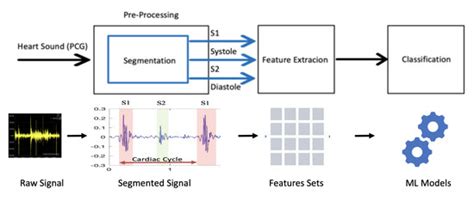 A New Method For Heart Disease Detection Long Short Term Feature Extraction From Heart Sound Data
