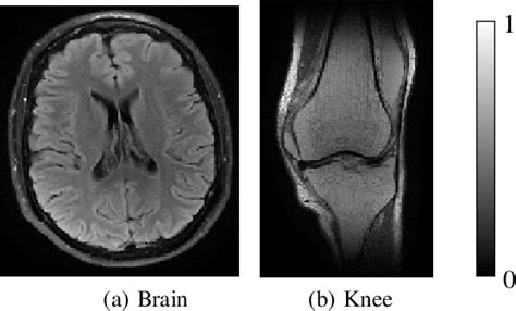 Figure 1 From A Complex Quasi Newton Proximal Method For Image