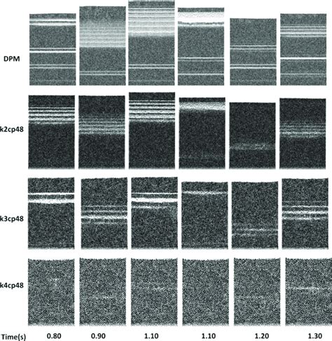 Temporal Evolution Of The Particle Distributions From Dpm And Emms Dpm Download Scientific