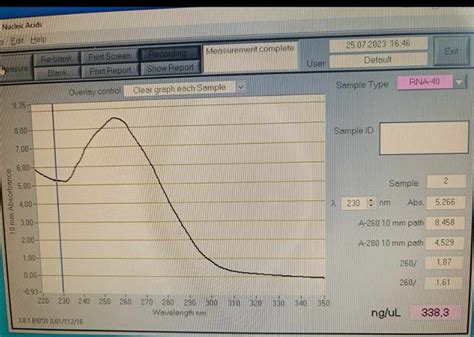 Problem With Trizol Rna Extraction What Should Be Purity Of Chloroform And Isopropanol