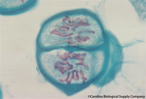 Prophase 1 Of Meiosis Under A Microscope