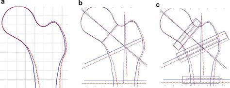 6 The Effect Of Patient Positioning On The Locations Of Critical
