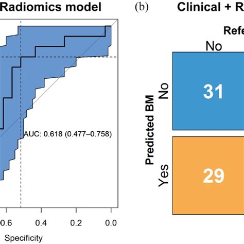 A Roc Curve And The Corresponding Confidence Interval Of 95 In Blue Download Scientific