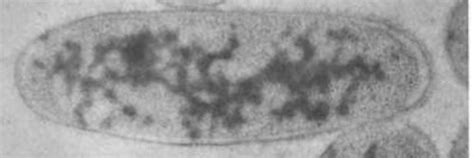 Bacterial Genome Flashcards Quizlet