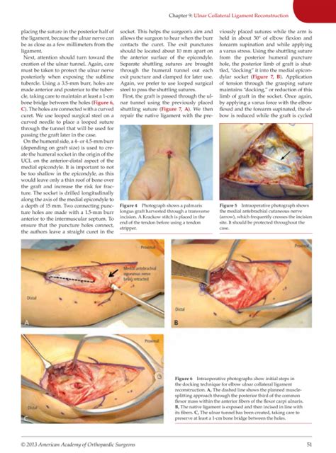 Atlas Of Essential Orthopaedic Procedures By Evan Flatow Global