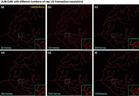 Figure 7 From Ultrafast Ultrasound Localization Microscopy By Conditional Generative Adversarial