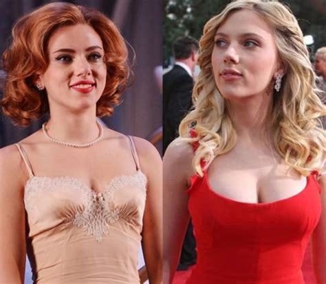 Scarlett Johansson Plastic Surgery Breast Reduction Before And After