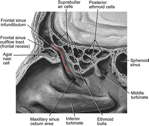 Frontal Sinus Shape Frontal Sinus Anatomy Function And Diagram Kvnazu