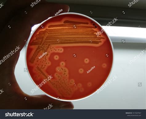 혈액판 위에 베타 헤몰리틱 스타필로코커스 아우레우스 스톡 사진 1917697967 Shutterstock