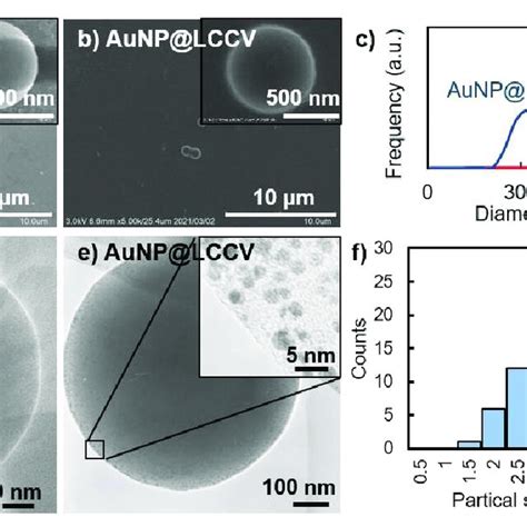 Electron Microscope Studies And Dynamic Light Scattering Of Vesicle