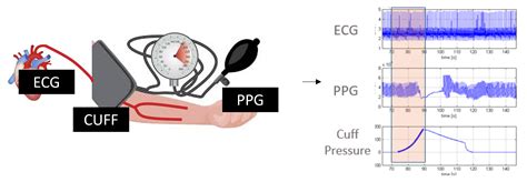 Hemodynamic Monitoring Simona Turcos Page