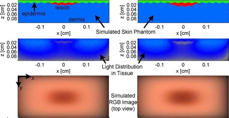Monte Carlo Modeling Simulates Light Transport In Skin The First Download Scientific Diagram