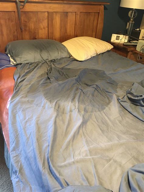 Adults Who Bed Wet Have Medical Problems Doctor Artofit