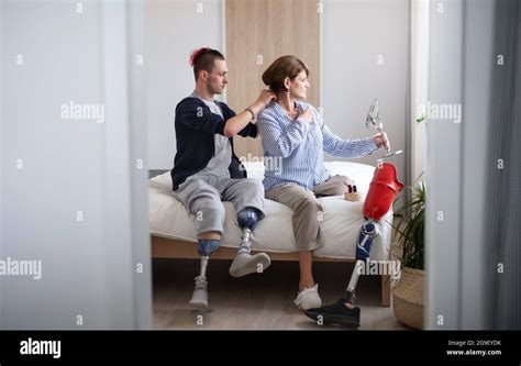 Bein Amputierte Frau Fotos Und Bildmaterial In Hoher Auflösung Alamy