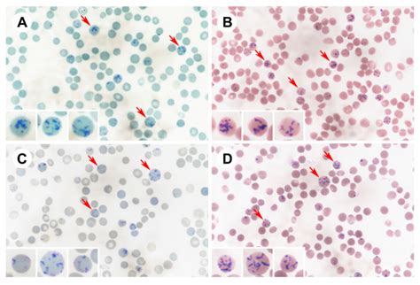 Impact Of Staining Methods And Human Factors On Accuracy Of Manual