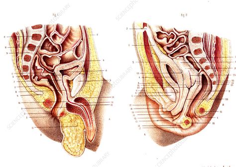 Humans Born With Both Male And Female Parts