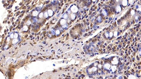 Fibulin 3 Monoclonal Antibody C1 Invitrogen 20 μl Unconjugated