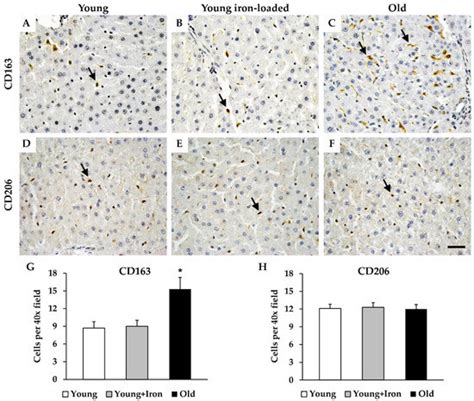 IJMS Free Full Text Hepatic Macrophage Abundance And Phenotype In Aging And Liver Iron