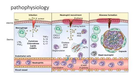 Abscesspptx