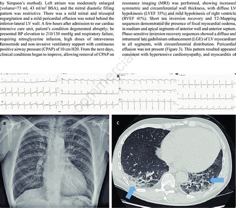 A Electrocardiogram On Admission Sinus Tachycardia With Left Axis Download Scientific Diagram