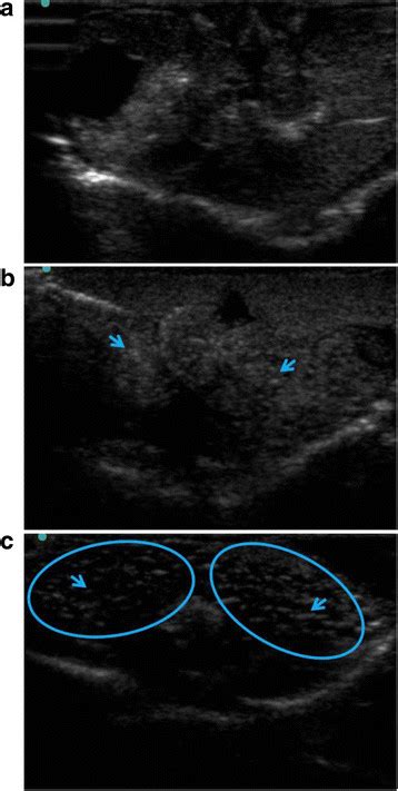 Ultrasonography Images Used For DGF Sex Identification Panel A Depicts Download Scientific