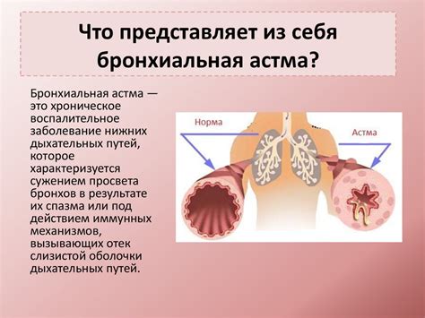 Бронхиальная астма - презентация онлайн