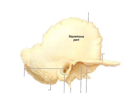Temporal Bone Quiz