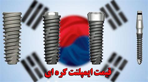 قیمت ایمپلنت کره ای ۱۴۰۲ آخرین قیمتشرایط اقساط تیبا بلاگ