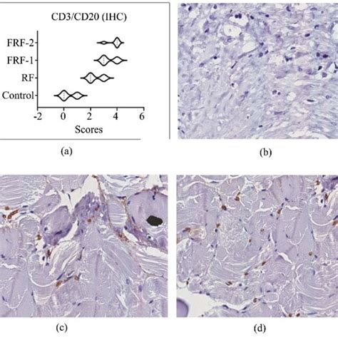 Analysis Of Lymphocyte Expression Cd3 Cd20 And Nk Cd57 A Scores