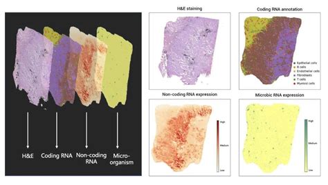 Cancers Stereo Seq实现ffpe样本分析，助力绘制肿瘤空间多组学图谱 哔哩哔哩