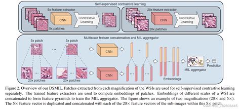 （wsi分类）wsi分类文献小综述scaling Vision Transformers To Gigapixel Images Vi Csdn博客