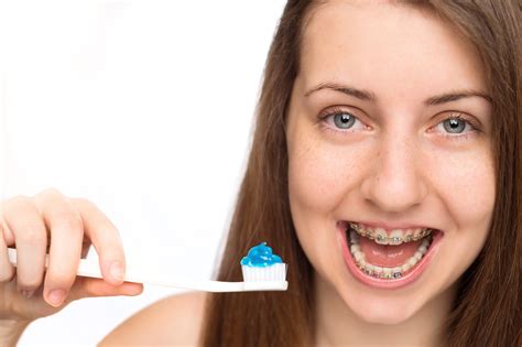 Braces Colors That Look Good Together