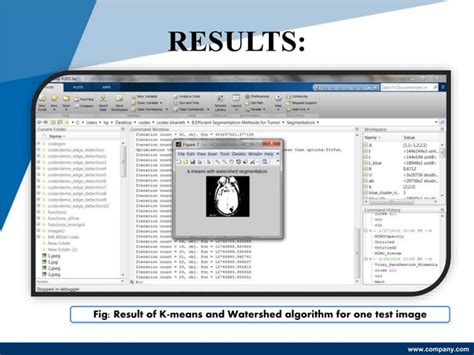 Ppt On Brain Tumor Detection In Mri Images Based On Image Segmentation Pptx Brain And