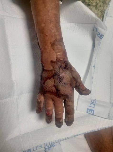 Fundraiser By Bryan Ferrell Help The Reddings Overcome Medical And