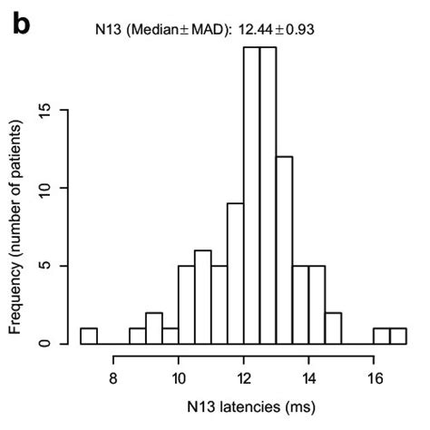 Characteristic Waveform Of The Cortical Response Of Trigeminal Ssep Download Scientific Diagram