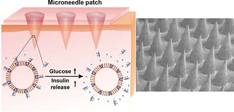 Microneedle Patches Loaded With Nanovesicles For Glucose Transporter