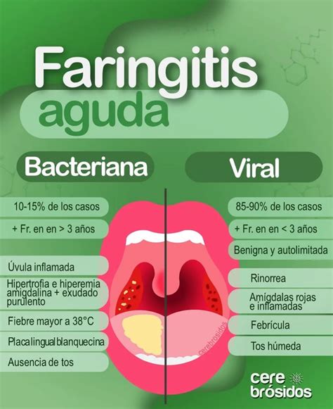 Cuidadores 𝐅𝐚𝐫𝐢𝐧𝐠𝐢𝐭𝐢𝐬 𝐚𝐠𝐮𝐝𝐚 🩺👨🏻‍⚕️🧑‍⚕️ Faringitis Aguda Viral Y