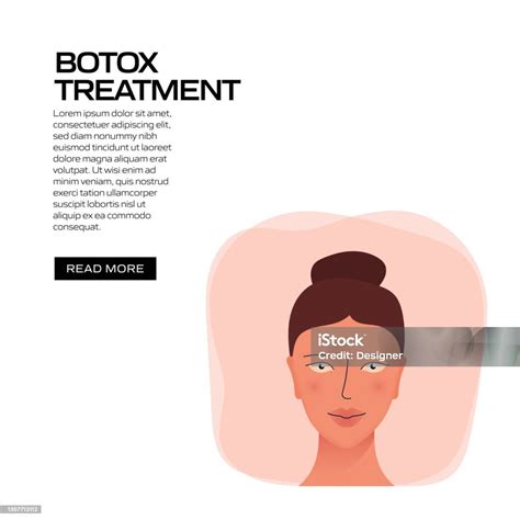 보톡스 트리트먼트 컨셉 컬러풀 벡터 일러스트레이션으로 플랫 카툰 스타일 뷰티 바디 케어 및 화장품 관련 현대 벡터 일러스트 러
