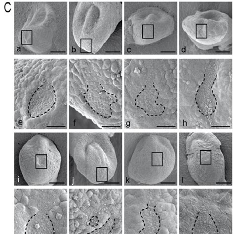 Laterality And Nodal Flow Defects And Abnormal Nodepnc Structure In