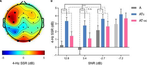Cortical Representation Of The Amplitude Modulation Of The Auditory Download Scientific Diagram