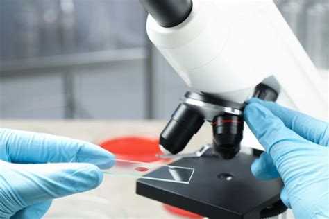 Berapa Kadar Leukosit Normal Penting Untuk Kekebalan Tubuh