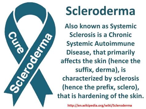 What Is Crest Disease Crest Syndrome Medlineplus Medical Encyclopedia Image Diseases Club Center