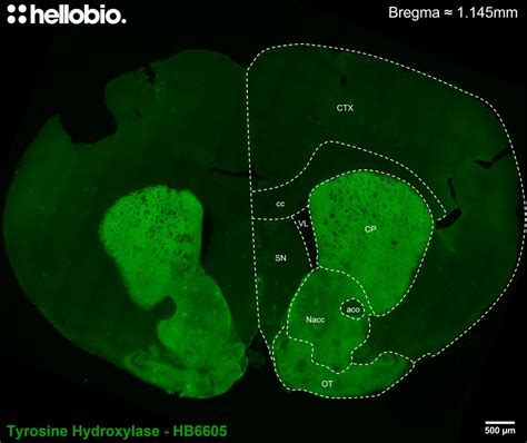 Anti Tyrosine Hydroxylase Antibody Validab™ Rabbit Polyclonal