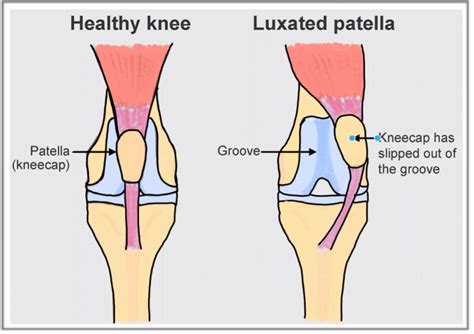 Patellar Luxation Southfields