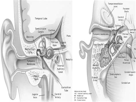 Complications Of Csom Pptx