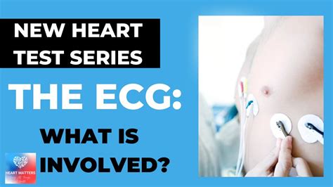 Heart Tests The Ecg What Is Involved Youtube