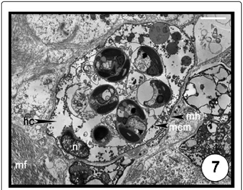 Transmission Electron Microscope Photograph Of Six Algal Cells Of