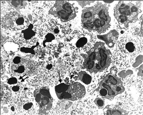 1 Electron Micrograph Of Polymorphonuclear Granulocyte Apoptosis In A Download Scientific