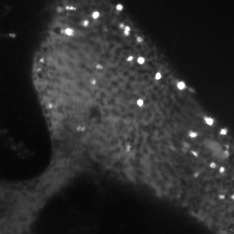 Phh3 Stained Image Segmentation A F K Sections Of The Original